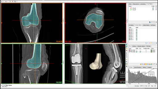 mimics21破解版下载|Materialise Mimics V21.0 最新中文版下载_当下软件园
